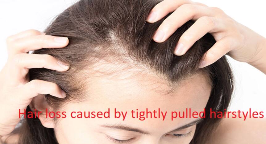 Dr Rashmi Shettyra Identifies 3 Common Mistakes That Can Cause Hair ...