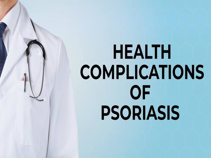 Got Psoriasis? Here's How It Can Get Worse If Left Untreated ...