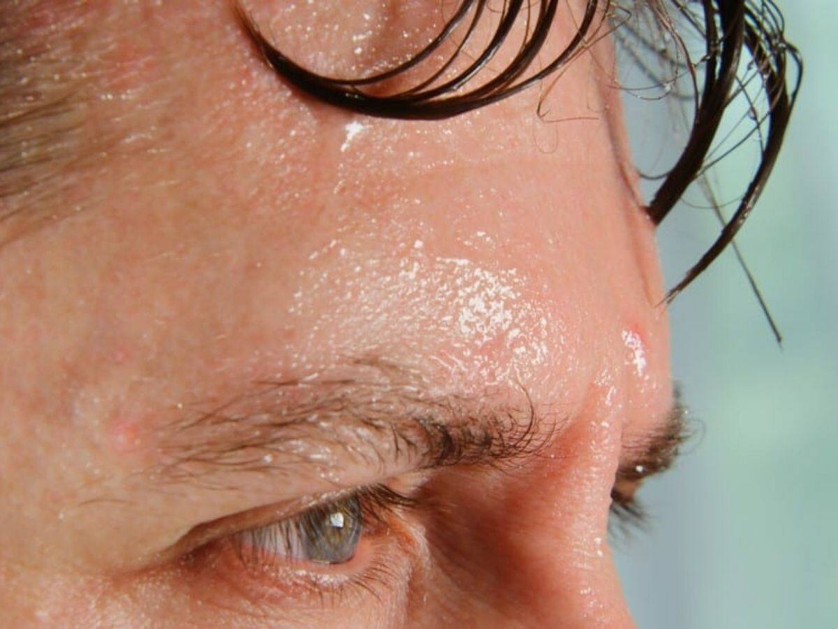 Head Sweating Reasons In Hindi | सर्दियों में सिर से पसीना निकलना इस ...