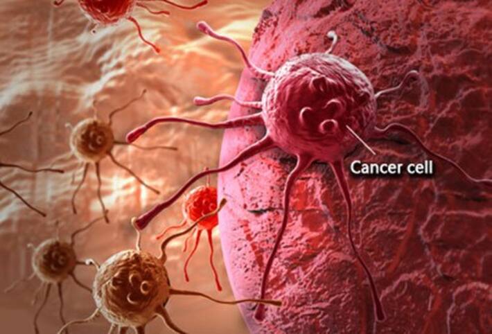 6 Most Common Cancers In Men And How to Recognise Their Symptoms ...