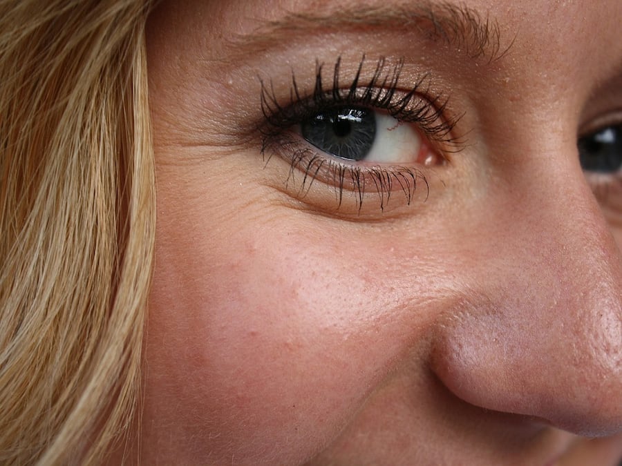 Wrinkles Cropping Up On Your Face? Skincare Treatments For A Better ...