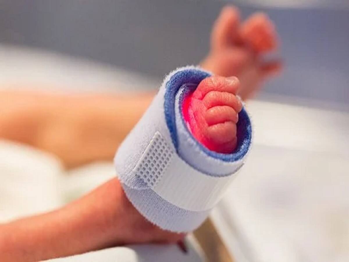 How To Build Immunity In Premature Babies | TheHealthSite.com