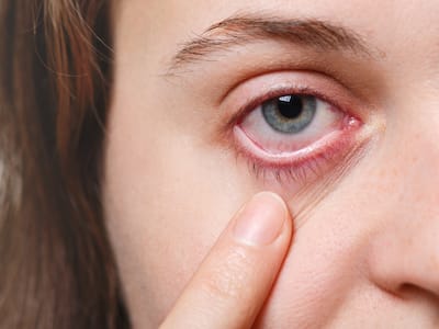 Look Out For These Common Eye Infections That Can Cause Permanent ...