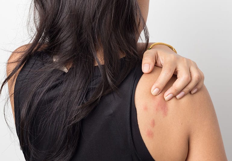 Scaly Patches To Burning Sensation: Beware of THESE 5 Warning Symptoms ...