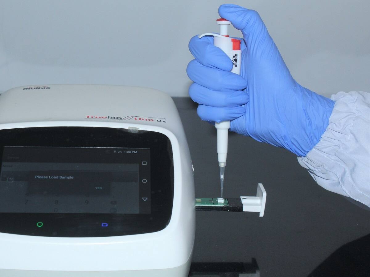 World TB Day 2022: India To Begin Door-To-Door Tuberculosis Screening ...