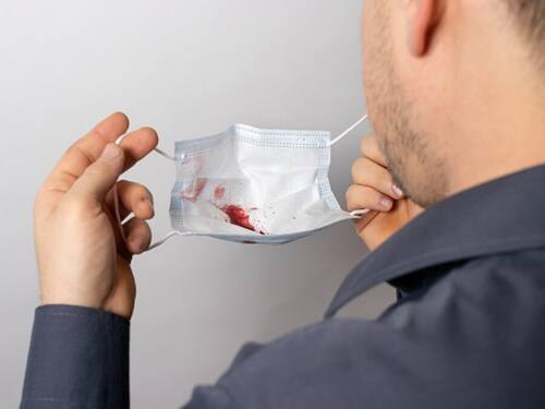 Man Coughs Up Blood After Successful Treatment Of TB, Docs Find A Large ...