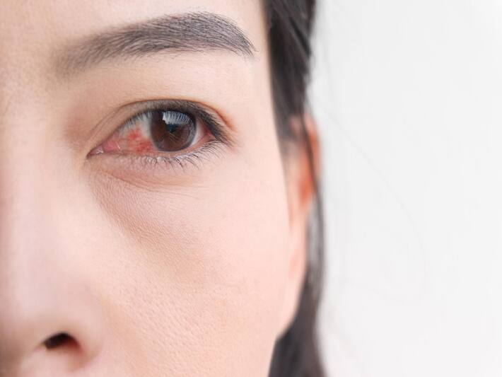 5 Signs Of Covid Infection That Show Up In Your Eyes | TheHealthSite.com