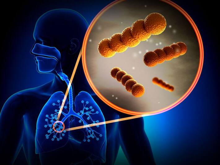 Pneumonia: How Fluid Forms Inside The Lungs And Then Damages It ...