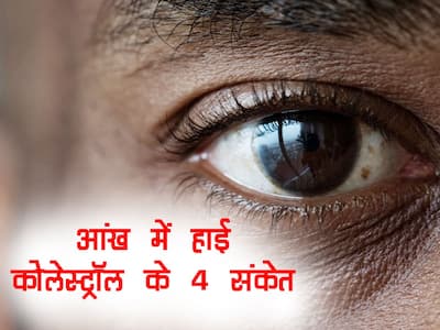 हाथ-पैर नहीं बल्कि आपकी आंख में भी दिखता है हाई कोलेस्ट्रॉल, इन 4 ...