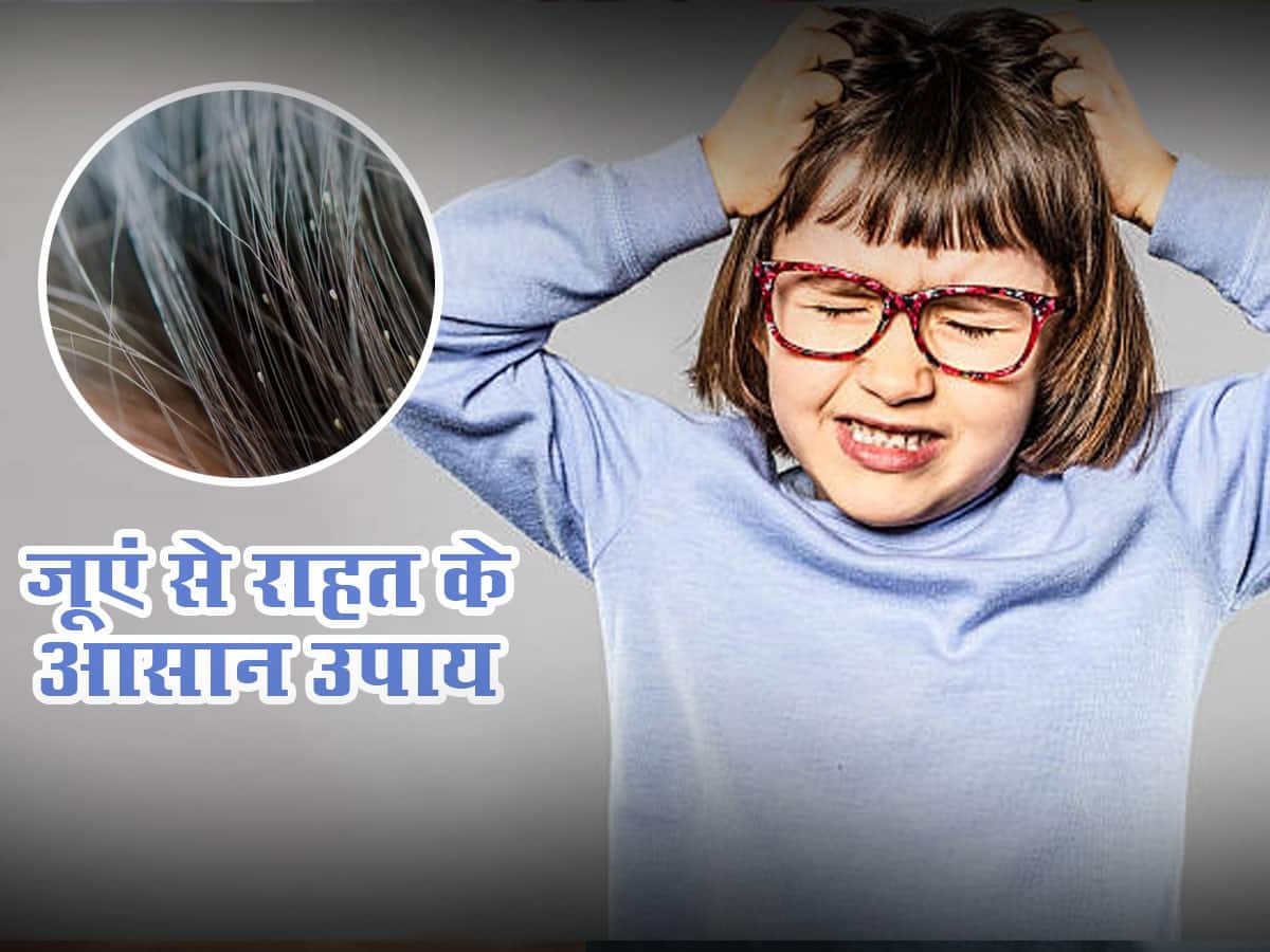 स्कूल खुलते ही बच्चों के सिर में दिखने लगी हैं जूं आजमाएं ये घरेलू