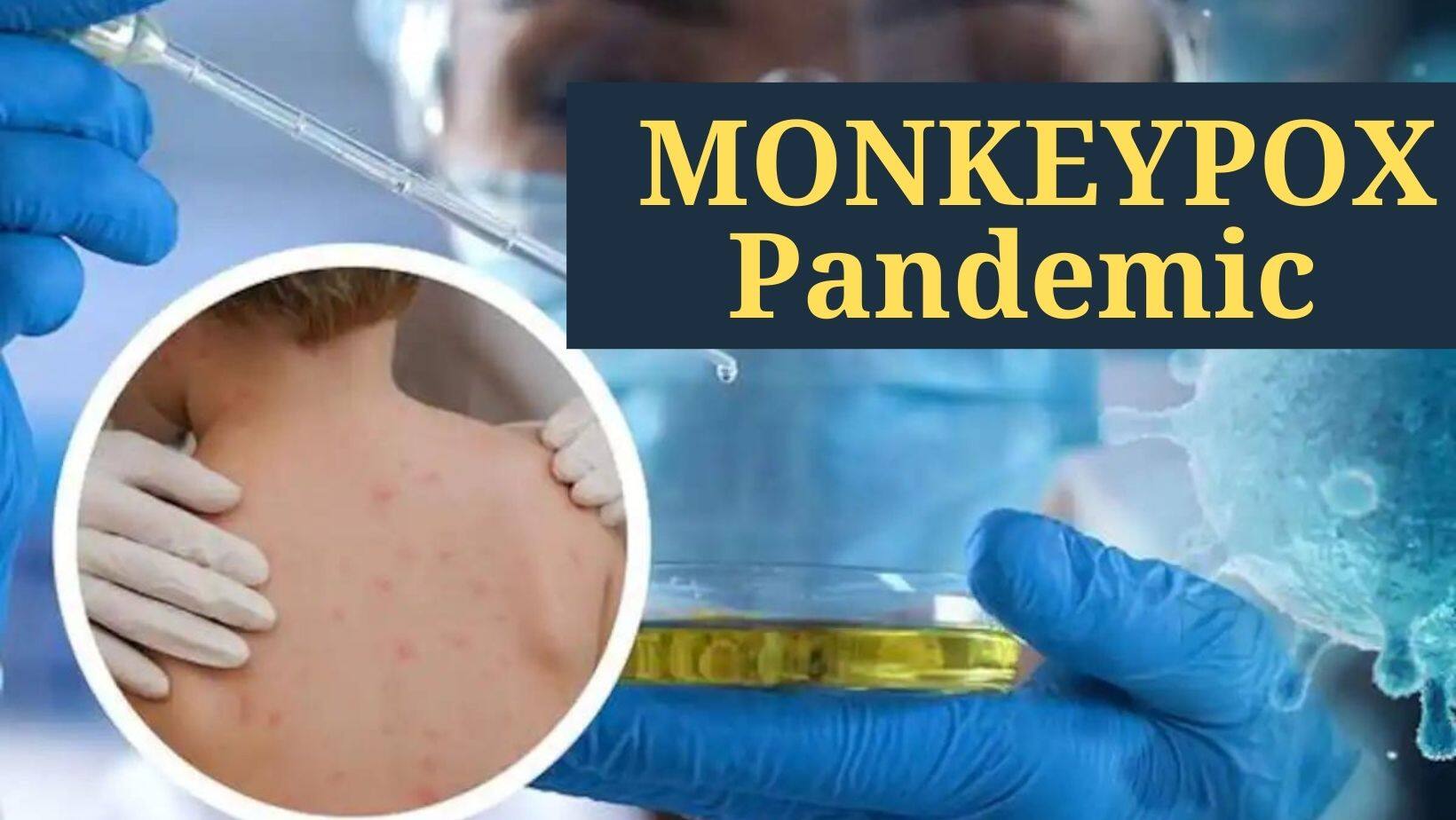 Monkeypox Declared Pandemic By World Health Network, Warns of Rapid ...