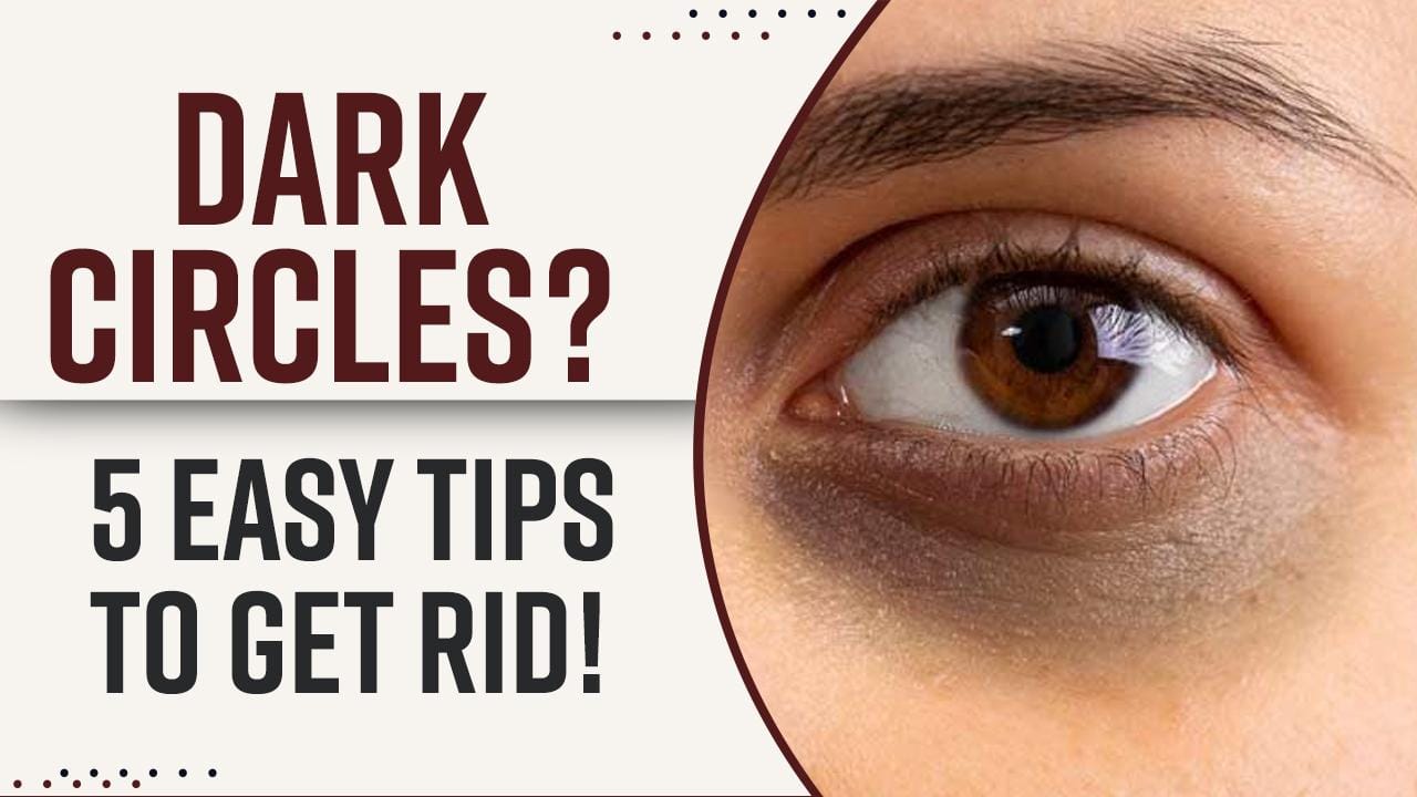 Dark Circles Remedies: Heres How You Can Get Rid Of Dark Circles At ...