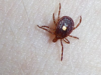 Bite From Lone Star Ticks Can Cause Acquired Red Meat Allergy: Symptoms ...