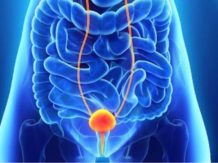 Organ Preservation Protocol: A Game-Changer In Muscle-Invasive Bladder ...