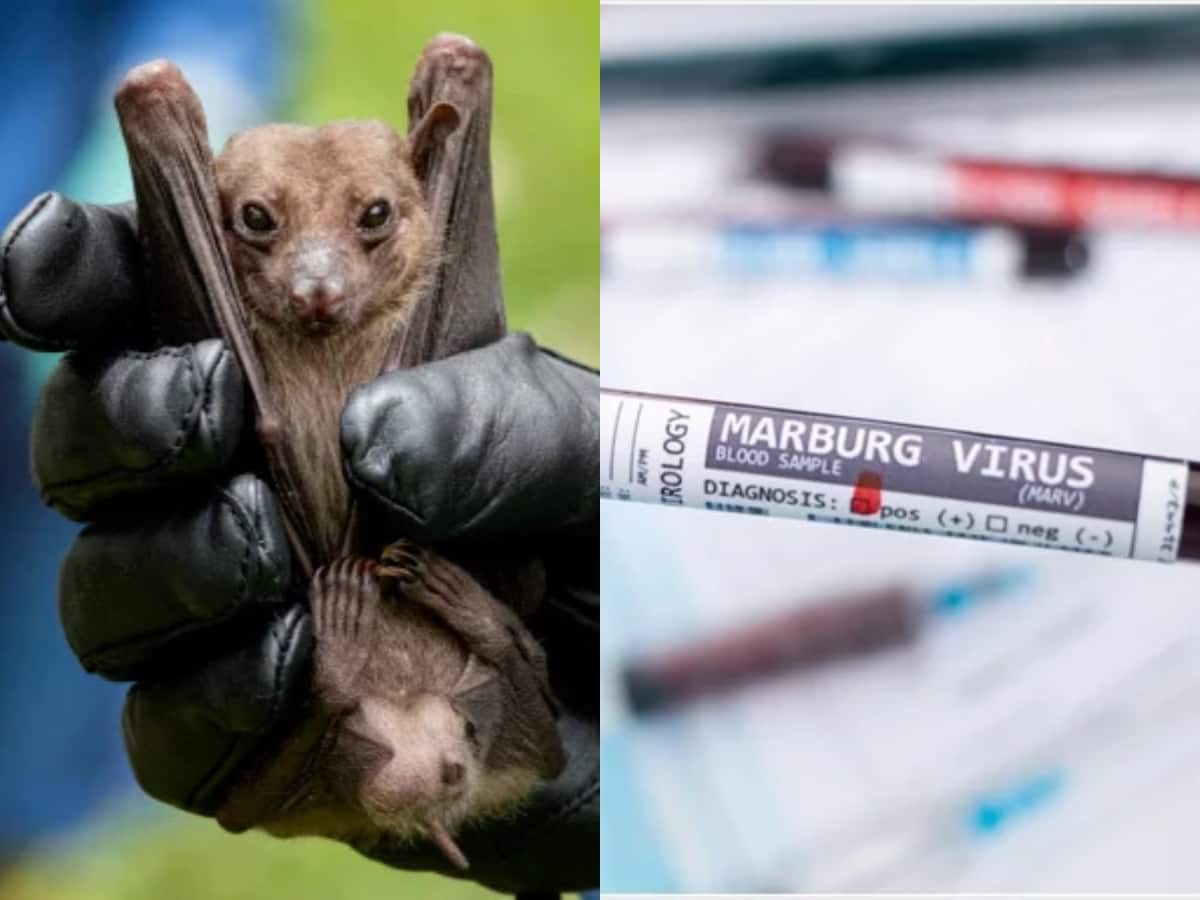 Fatal Marburg Virus Claims Two Lives: Critical Symptoms Of The Disease ...