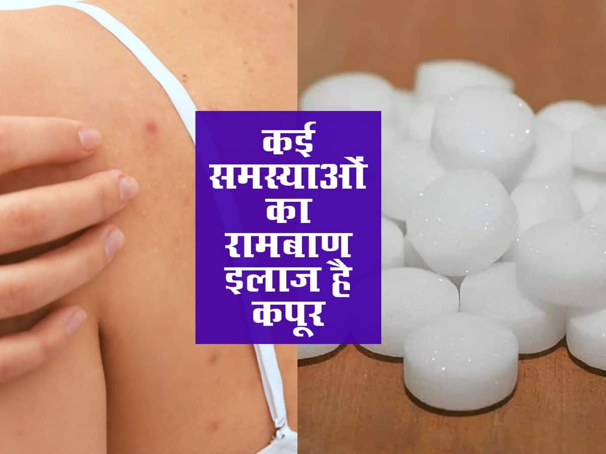 कपूर का इस्तेमाल कैसे करें: खुजली और दाने जैसी इन 6 समस्याओं में इस्तेमाल करें कपूर | Camphor ...