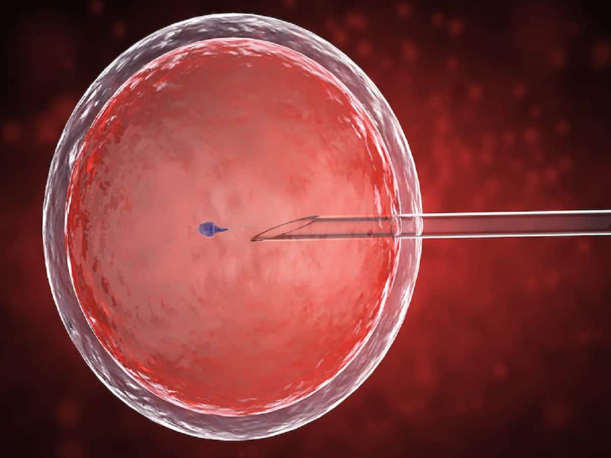 IVF Is Not Just For Infertile Couples: Know Who All Can Opt For This ...