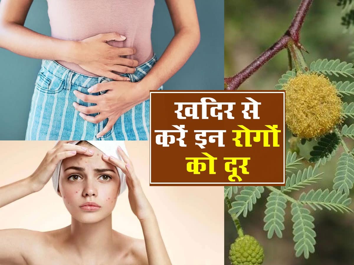 Khadira benefits: पेट की बीमारियों से लेकर स्किन प्रॉब्लम्स तक खदिर से ...