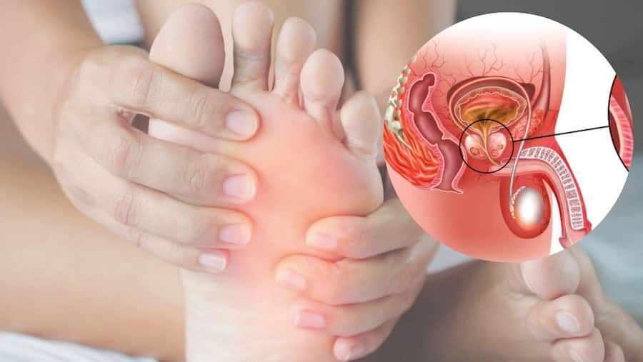 Prostate Cancer Symptoms: 3 Signs That Can Indicate Tumour Has Spread ...