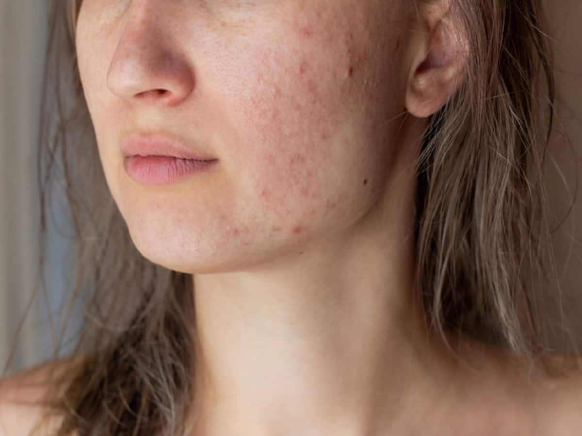 Many Underlying Health Conditions First Appear As Skin Problems: Skin ...