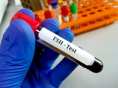 Fertility Tests for Women: All You Need To Know About FSH Test ...