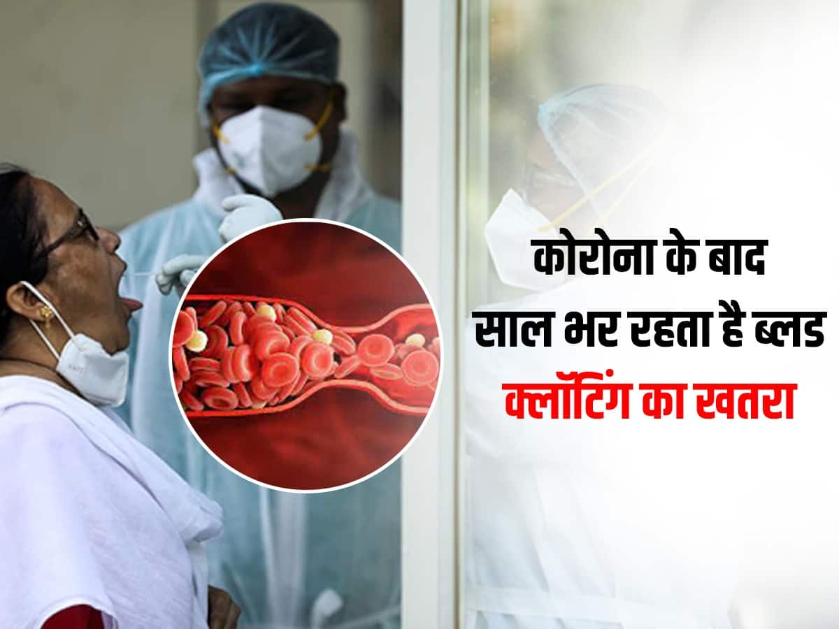 कोरोना के बाद 1 साल तक लोगों में ज्यादा रहता है ब्लड क्लॉटिंग का खतरा ...