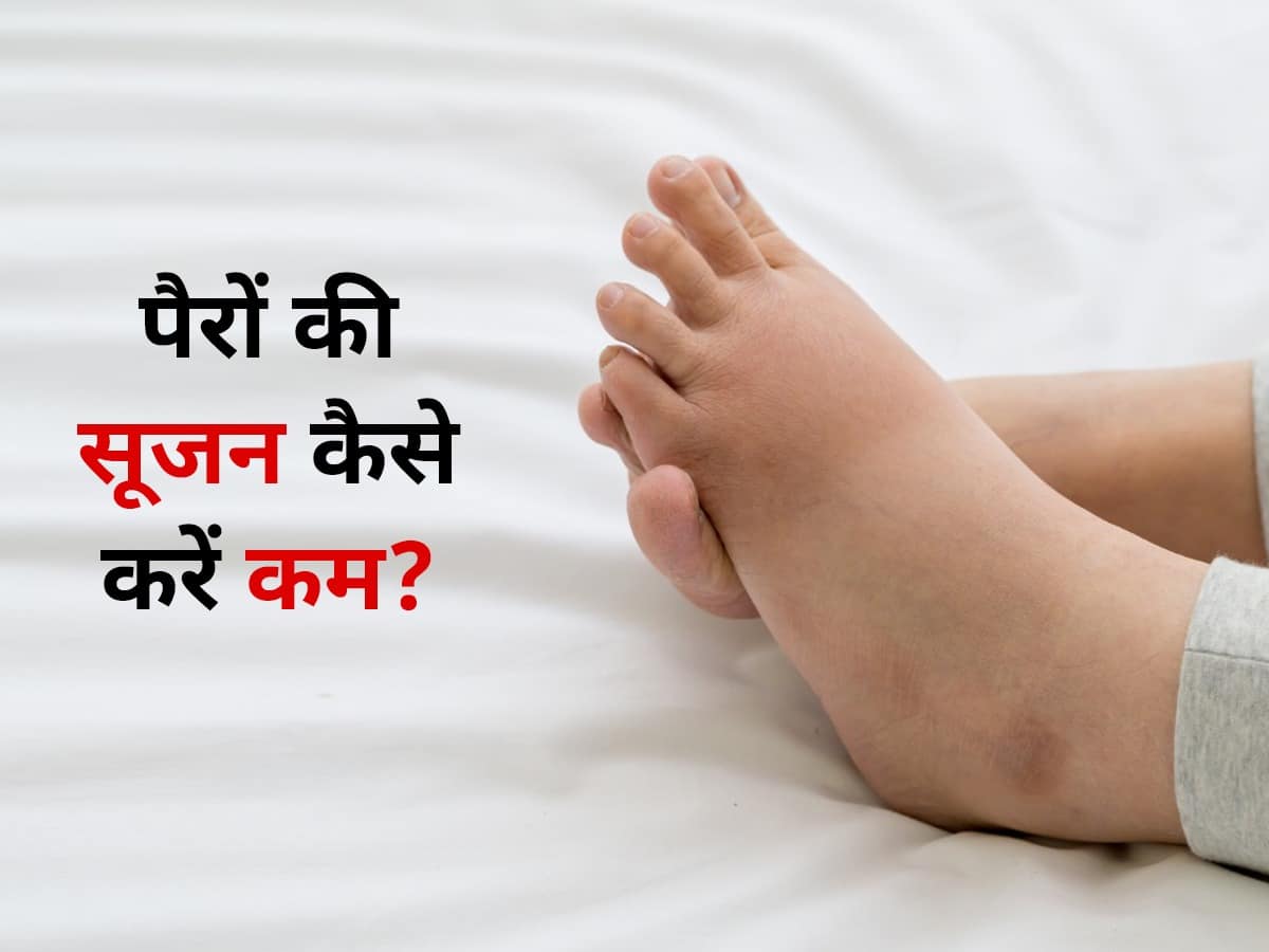 Pairo ki sujan kaise kam kare : पैरों पर चढ़ी सूजन और दर्द से आराम ...