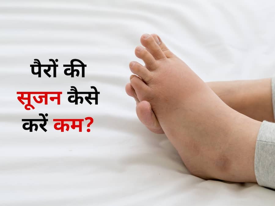 Pairo ki sujan kaise kam kare : पैरों पर चढ़ी सूजन और दर्द से आराम ...