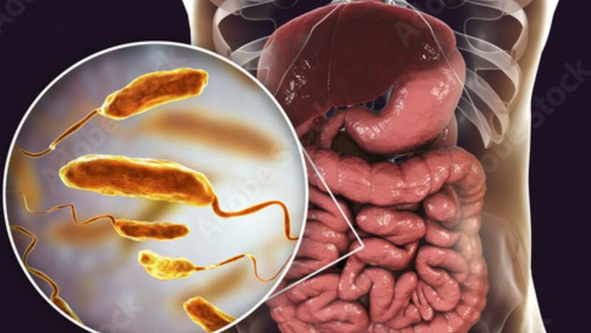 Cholera Warning Symptoms: 3 Signs Your Cholera Is In A Serious Stage ...