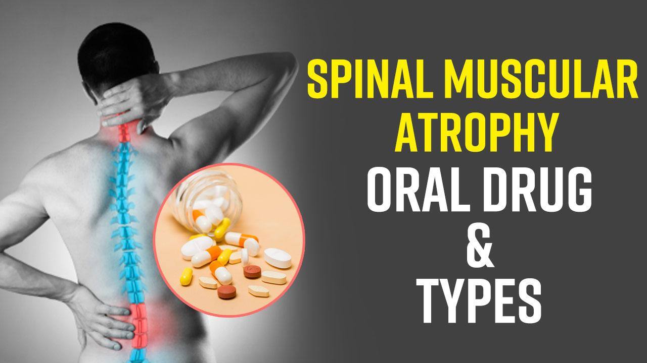 Spinal Muscular Atrophy In Children: Know About The Oral Drug In SMA ...