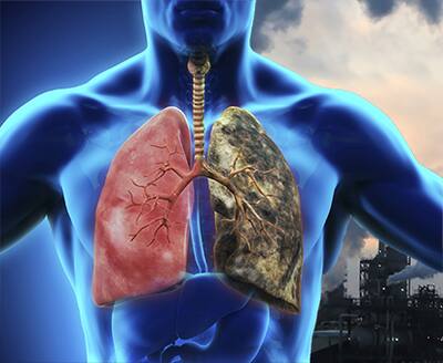 Air Pollution Grips India: Bihar Tops The List; Check Names of Top 10 ...