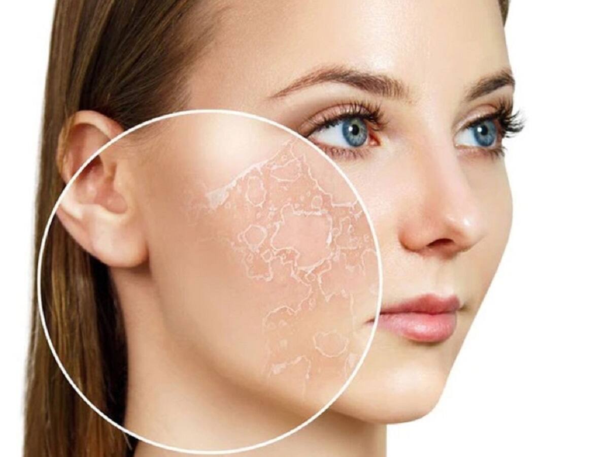 How To Treat Flaky Skin On The Face At Sara Gardner Blog How To Treat Flaky Skin On The Face At Sara Gardner Blog