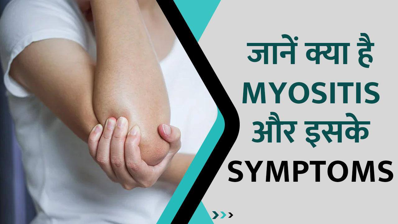 जानें क्या है Myositis जिसका शिकार हैं समांथा प्रभु Watch Video