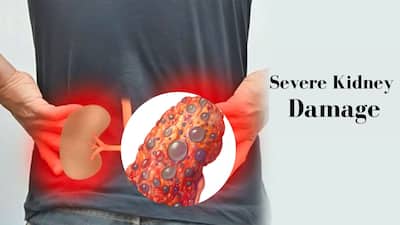 Severe Gall Bladder Infection Can Damage Your Kidneys Completely ...