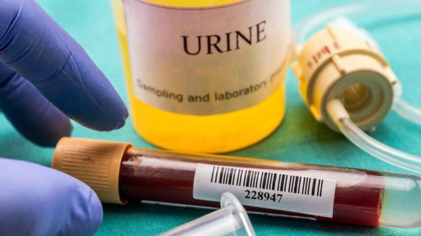 Urinary Bladder Stone: Difficulty In Peeing And 5 Other Warning ...