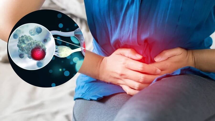 Cervical Cancer Can Damage Your Uterus: Here's Why You Should Get ...