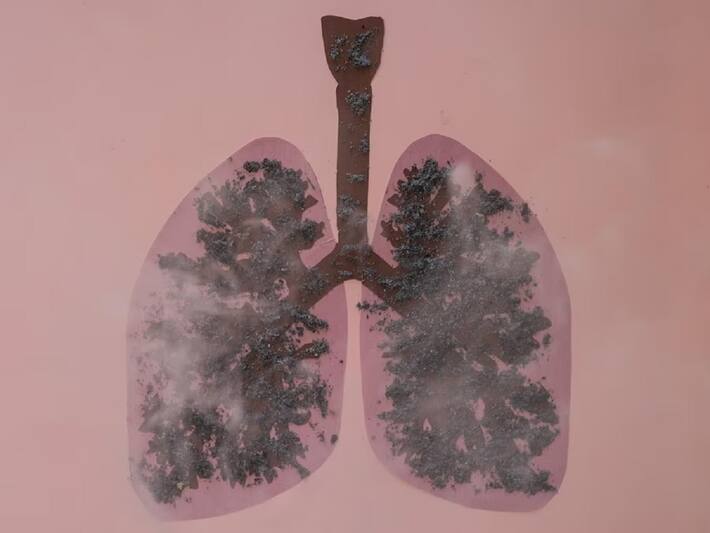 Black Lung Disease: All You Want To Know About This Job-Related Illness ...
