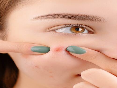 Blind Pimples: Painful Bumps That Can Be Felt But Not Easily Seen ...