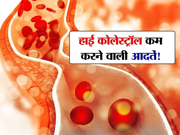 High Cholesterol Control Tips न गोली न सप्लीमेंट्स घर बैठे बैठे इन 5