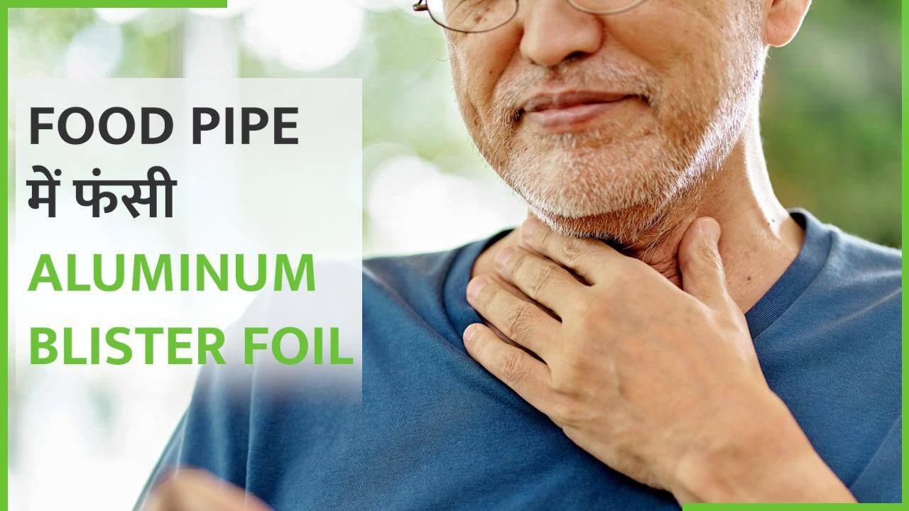 मरीज की Food Pipe में फंस गई थी एल्यूमीनियम ब्लिस्टर फॉयल, जानें पूरा ...