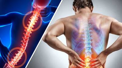 Are You Suffering From Spine Disorders? Doctor Explains 5 Early Signs ...