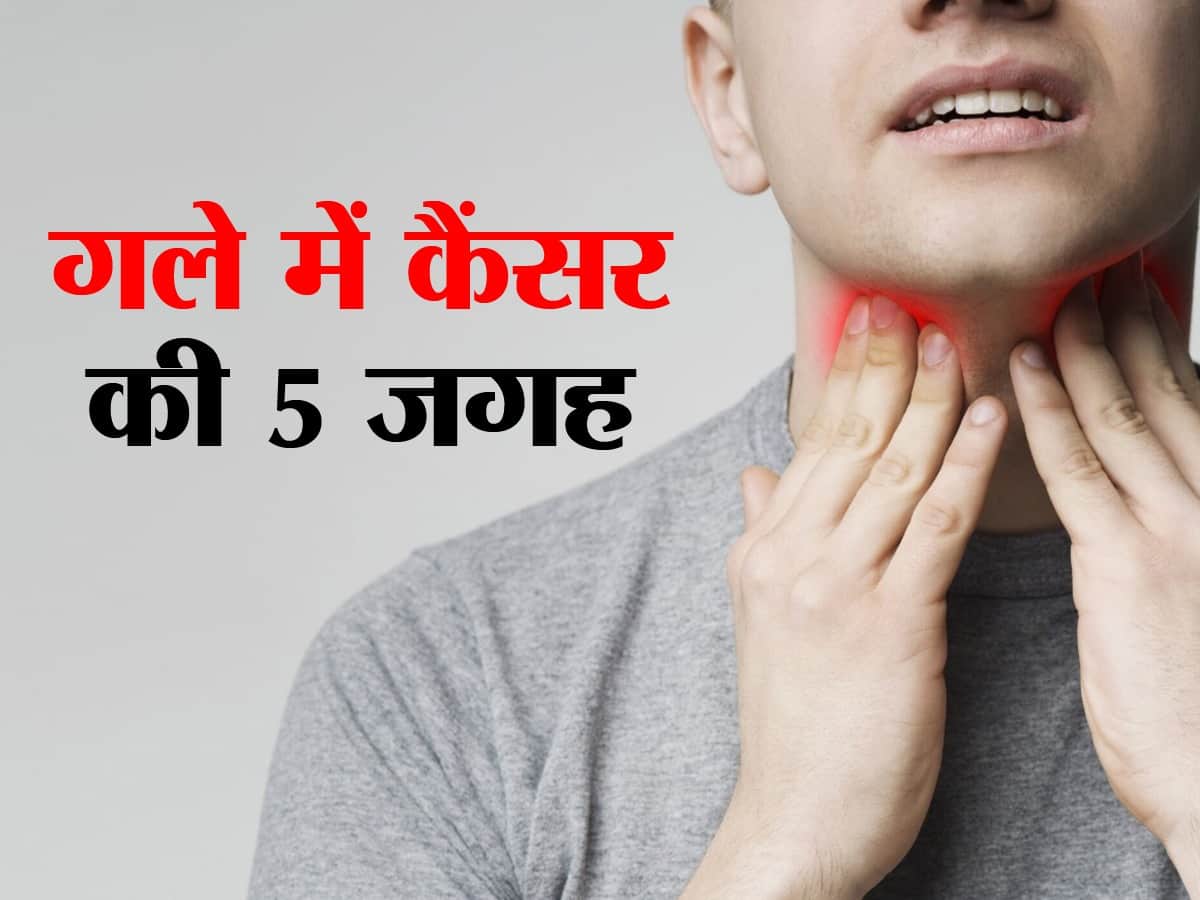 Throat Cancer गले में कैंसर की 5 छिपी हुई जगह हिंदी