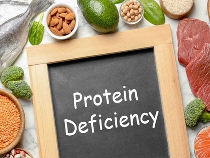 Protein deficiency symptoms : शरीर को नहीं मिल रहा सही प्रोटीन बताते ...