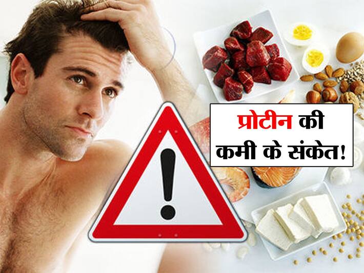 Protein deficiency symptoms : शरीर को नहीं मिल रहा सही प्रोटीन बताते ...