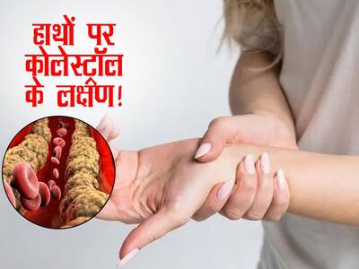 High Cholesterol Warning Signs on Hand : हाई कोलेस्ट्रॉल की परेशानी में ...