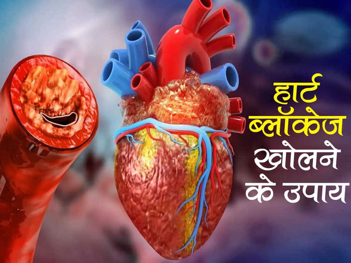 Heart Blockage हार्ट ब्लॉकेज खोलने के लिए फॉलो करें ये आसान से टिप्स