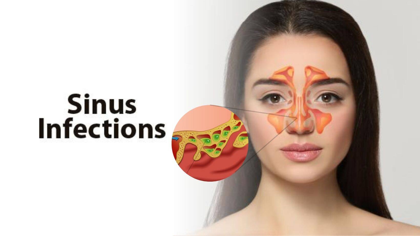 Sinus