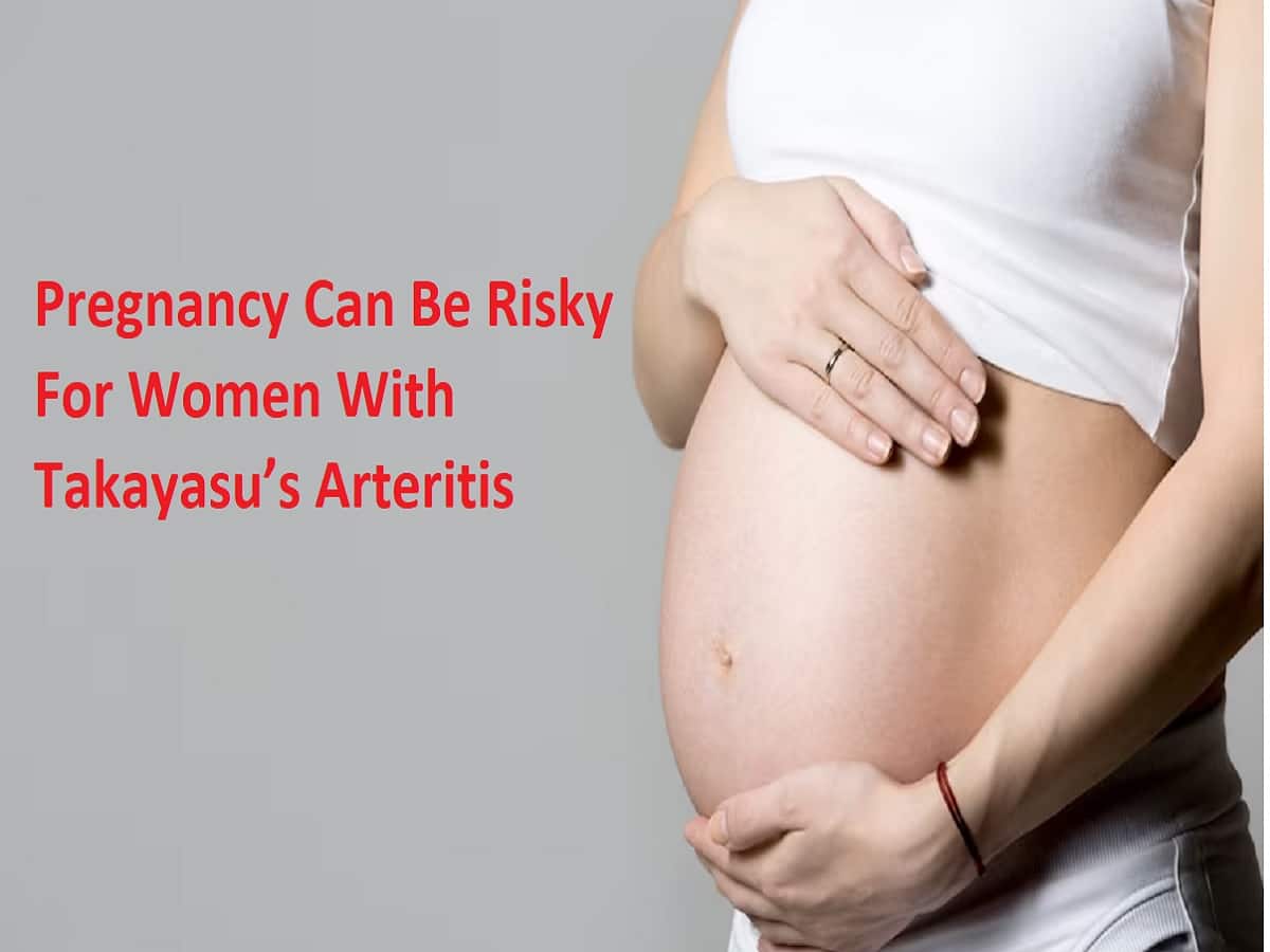 Pregnancy Can Be Risky For Women With Takayasu’s Arteritis: Know Why | TheHealthSite.com