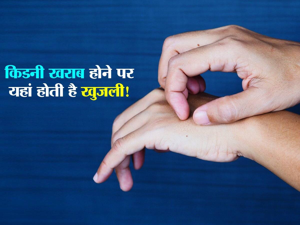 किडनी खराब होने पर शरीर के इस अंग में होने लगती है तेज खुजली! जानें ...