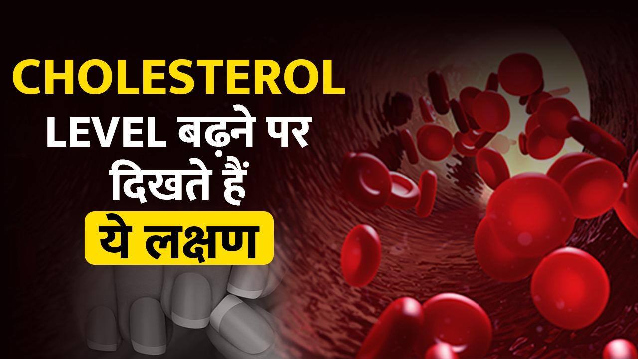 Cholesterol का लेवल बढ़ने पर नाखूनों में दिखते हैं ये लक्षण, Watch Video | TheHealthSite.com हिंद